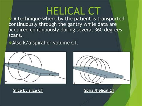Helical And Multislice Ct Pptx Cameras And Camcorders Consumer