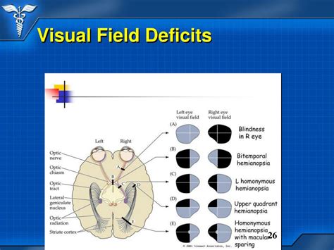 Ppt Assessment And Treatment Of The Stroke Patient Powerpoint Presentation Id2109179