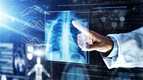 Invenio Completes Enrolment In Ai Based Lung Cancer Imaging Trial Medical Device Network