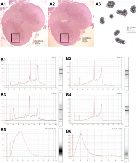 Laser Capture Microdissection LCM Permits Collection Of High Quality Download Scientific