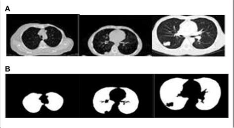 Figure 1 From Medical Image Segmentation Algorithm For Three Dimensional Multimodal Using Deep