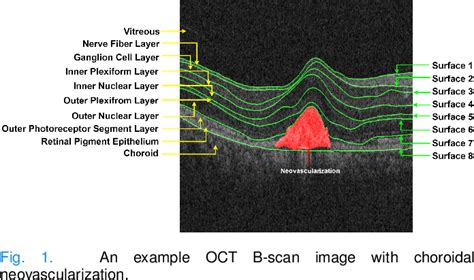 Figure 1 From Graph Attention U Net For Retinal Layer Surface Detection And Choroid
