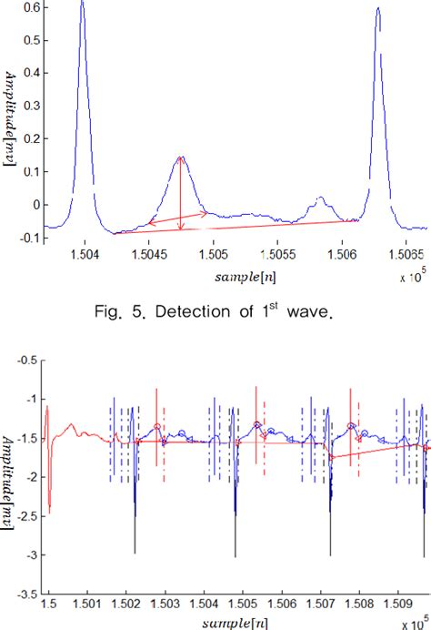 Figure 5 From P Waves And T Wave Detection Algorithm In The Ecg Signals