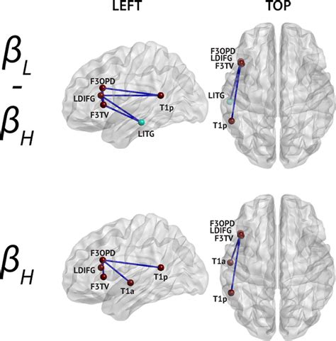 Connections Disclosing Significant Correlation Between RsFC And Disease Download Scientific