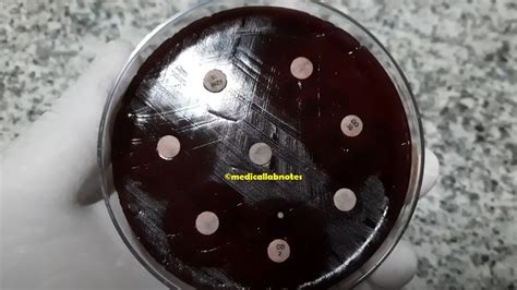 Aerococcus Viridans Introduction Morphology Pathogenicity Lab