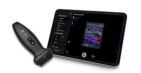 Mindray Introduces Te Air E5m Wireless Handheld Ultrasound To