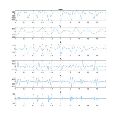 an ieeg signal and its wavelet decomposition into four details and an