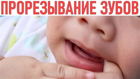 ПРОРЕЗОВАНИЕ ЗУБОВ У МАЛЫША | Что нужно знать | Как помочь ребенку в ...