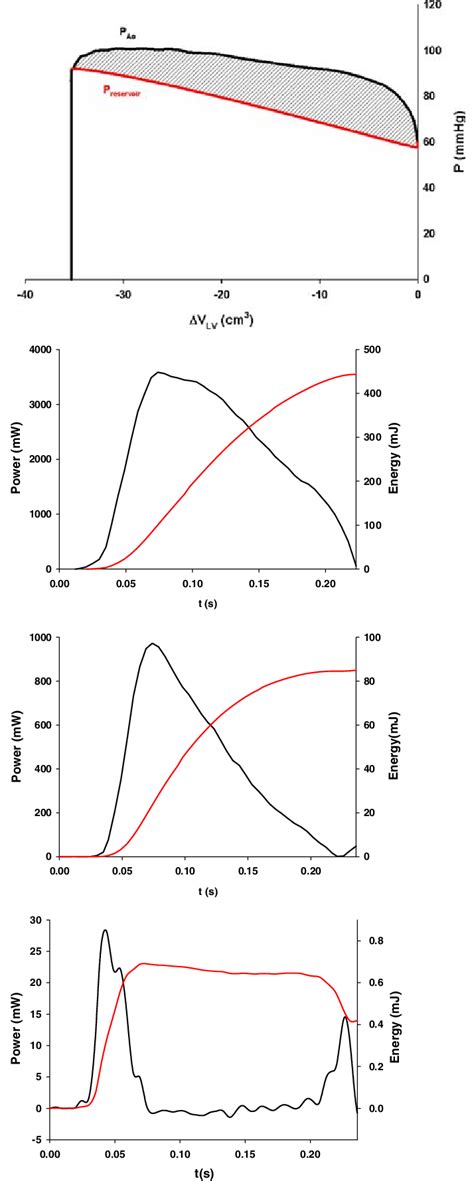 The Energetics Of Lv Contraction And Ejection At The Top Is An Lv Pv