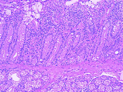 Duodenum Slide Labeled