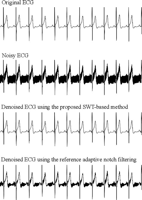 an efficient algorithm based on wavelet transform to reduce powerline