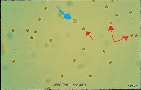 Kaarten Urine Sediment Exam Quizlet