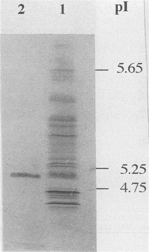 Size Exclusion Profile Of The P12 Peak On Hiload Superdex The Download Scientific Diagram