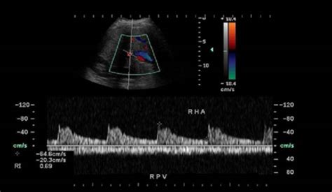 Doppler Quiz Flashcards Quizlet