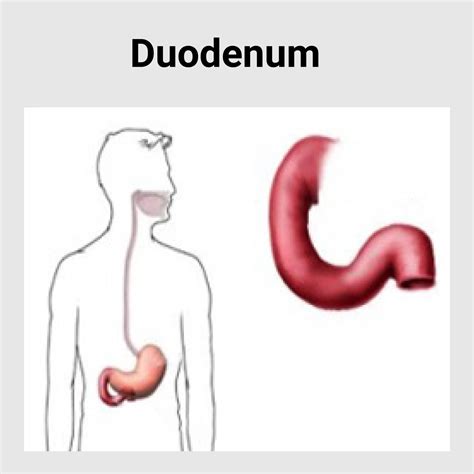 Duodenum Disease Best Gastroenterology Hospital In India