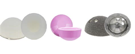 China Professional Medical Hip Implant Titanium Bipolar Hip Joint Prosthesis Manufacturer And