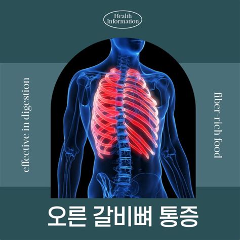 오른쪽 갈비뼈 통증 발생하는 원인 찾기 오른쪽 갈비뼈 아래 위 통증 네이버 블로그 오른쪽 갈비뼈 통증 발생하는 원인 찾기 오른쪽 갈비뼈 아래 위 통증 네이버 블로그