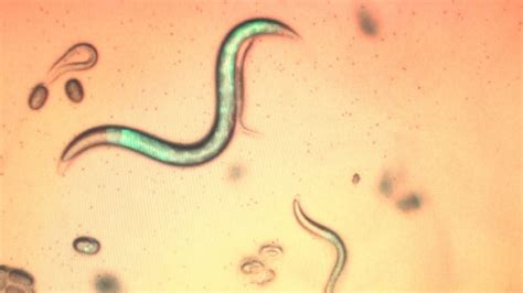 What A Glowing Green Worm Can Teach Us About Our Immune Systems Pbs News