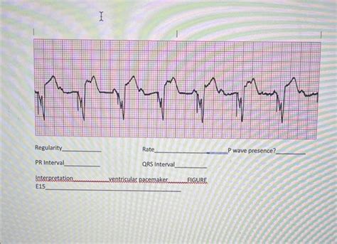 solved regularity rate pr interval qrs interval