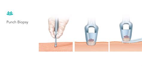 Medical Dermatology Lotus Dermatology