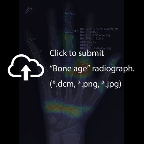 Bone Age Radiologist App