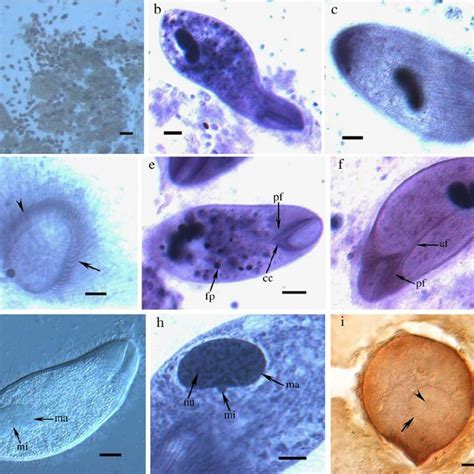 Schematic Drawing Of The Nuclei Showing Their Relative Position A E Download Scientific
