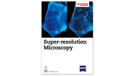 Superresolution Microscopy Ebook