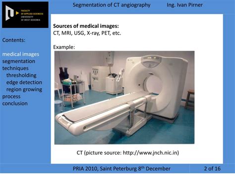 ppt segmentation of ct a ng iography based on a combination of