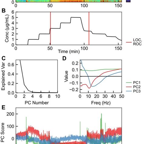 spectral characteristics of eeg during propofol anesthesia a
