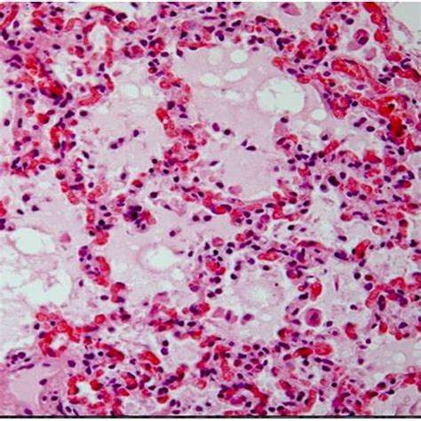 From Left To Right A Hande Staining Let A Leukocyte Bronchial And Download Scientific