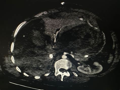 Gem On Linkedin Glubran