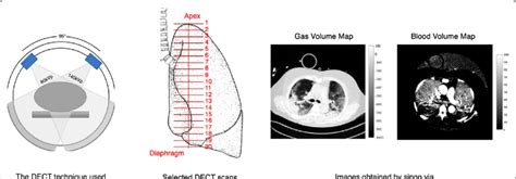 Dual Energy Computed Tomography Dect Image Acquisition And Analysis Download Scientific