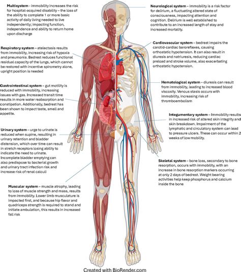 The Epidemic Of Immobility In Hospitalised Patients How To Get Your