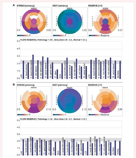 Pet Ct Perfusion Study Demonstrating Segmentation Performed Based On