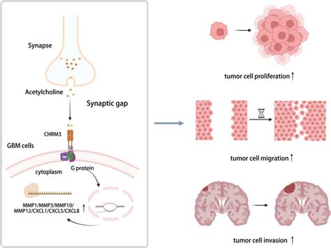 Chrm3 Is A Novel Prognostic Factor Of Poor Prognosis And Promotes Glioblastoma Progression Via