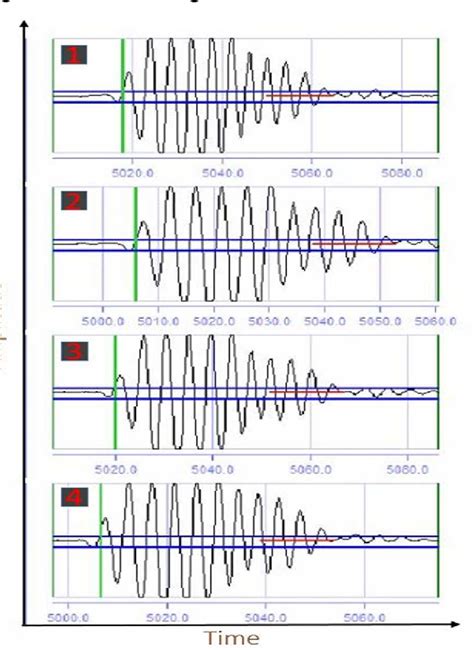 Figure 1 From Automated Defect Classification In Semiconductor Devices