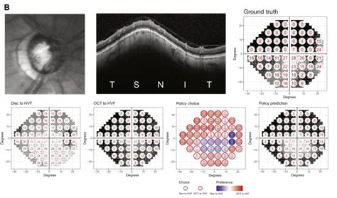 Policy Driven Multimodal Deep Learning For Predicting Visual Fields From The Optic Disc And Oct