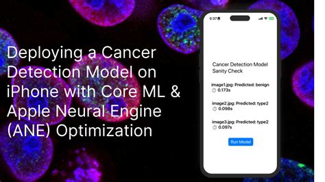Deploying a Cancer Detection Model on the iPhone with Core ML & Apple ...