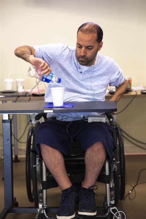 Complete Tetraplegia Hand Function Improves With Combo Treatment Rehab Management