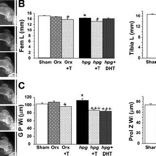 Effects Of Sex Steroid Depletion Or Treatment On Bone Length And Download Scientific Diagram