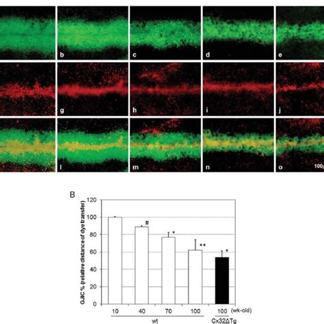 —gap Junctional Intercellular Communication In The Rat Livers Of