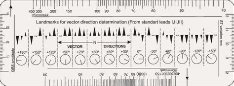 How To Calculate Qtc Manually Daxinsider