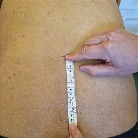 Schober Test Basic Assessment Position Download Scientific Diagram