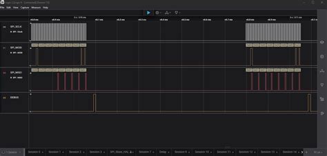 Solved Spi Miso Shifted Stmicroelectronics Community
