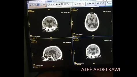 Hafiz Muhammad Ehtisham Raza Posted On Linkedin