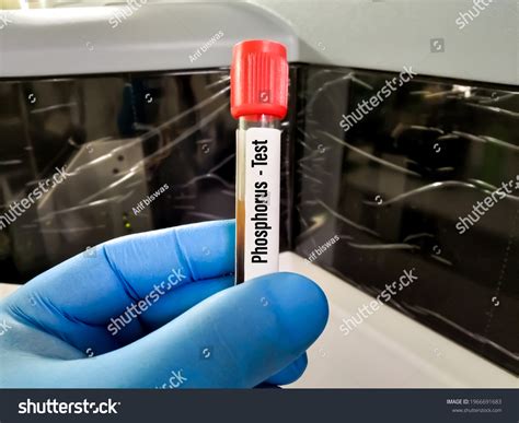 Lab Tube For Phosphorus At Alexander Feinstein Blog