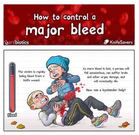 Brown Journal Of Hospital Medicine On Twitter How To Control A Major Bleed Artibiotics Bjhm