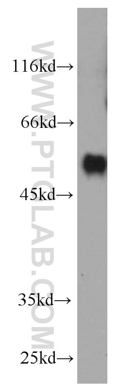 Antithrombin Iii Antibody 66052 1 Ig
