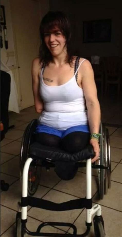 Девушка Без Рук И Ног Фото —