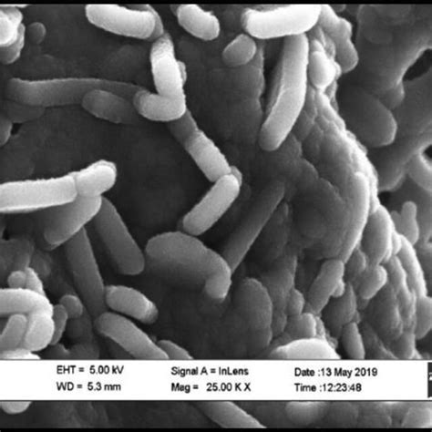 High Resolution Scanning Electron Microscopy Hrsem Micrographs Of The